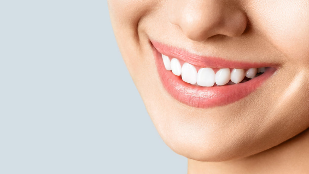 Teeth-Whitening - Bayshore Dental